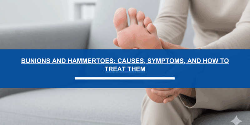 Bunions and Hammertoes: Causes, Symptoms, and How to Treat Them - City ...