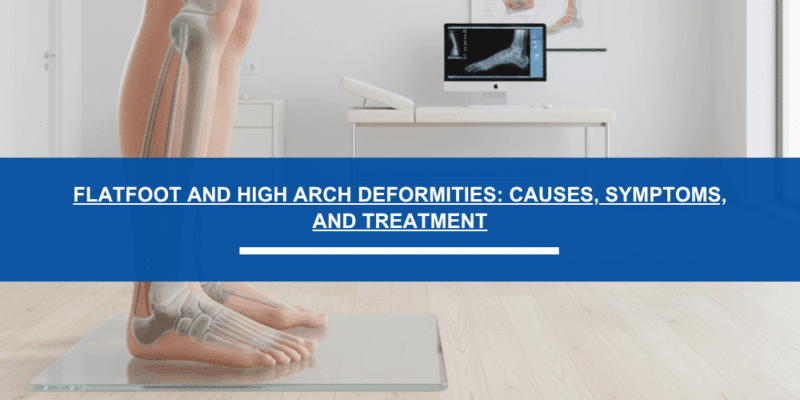 Flatfoot and High Arch Deformities: Causes, Symptoms, and How to Treat ...