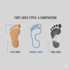 Flatfoot and High Arch Deformities: Causes, Symptoms, and How to Treat ...